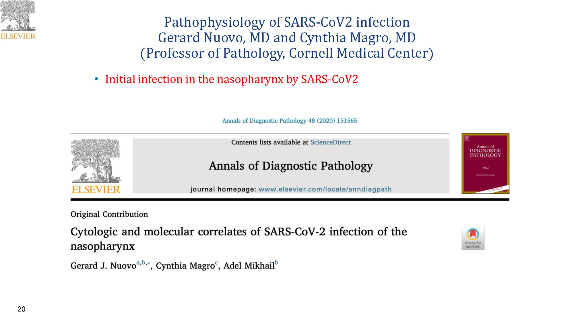 20 Pathophysiology of SARS - CoV2 infection Gerard Nuovo, MD and ...
